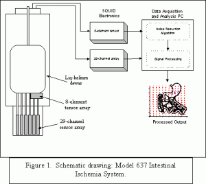Intestinal Ischemia System | Tristan Technologies, Inc.